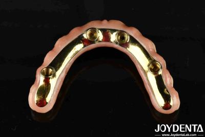 China Custom-made Ti-Bar Zirconia Hybrid Bridge Resistant To Corrosion And Wear Restoring Chewing Function With Precision for sale