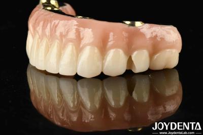 China Transform Your Dental Restoration With Ti-Bar Zirconia Hybrid Bridge Durable And Long-Lasting for sale