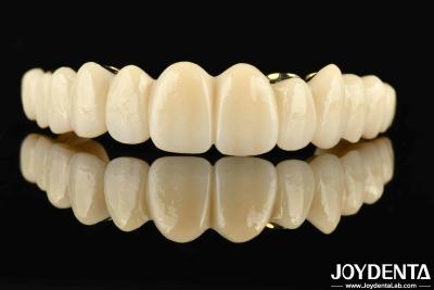 China Custom-made Ti-Bar Zirconia Hybrid Bridge The Perfect Combination For Comfort And Functionality for sale