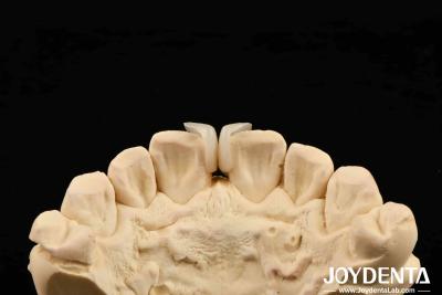 Cina Alta resistenza Micro Veneer spessore 0,2 mm e prestazioni affidabili in vendita