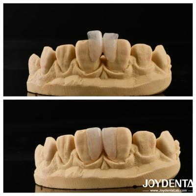 Cina Facile da installare Micro Veneer Soluzione definitiva per la decorazione degli interni Spessore 0,2 mm in vendita