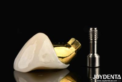 Chine Couronne et pont d'implant de longue durée pour restaurer les dents manquantes à vendre