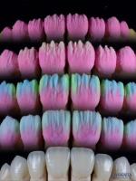China The Joydenta Ceramic Veneer Process for sale