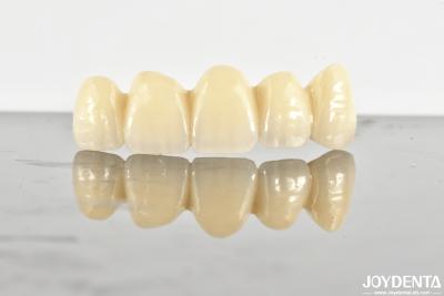 China Revolutionize Aesthetics & Strength: Introducing Our Multi-Layered Chromatic Zirconia Bridge for sale