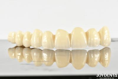 China Revolutionize Aesthetics & Strength: Introducing Our Multi-Layered Chromatic Zirconia Bridge for sale