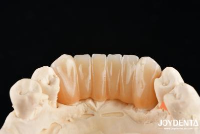 China Unveil True Biomimicry: Introducing Our Multi-Layered Zirconia Aesthetic Bridge for sale
