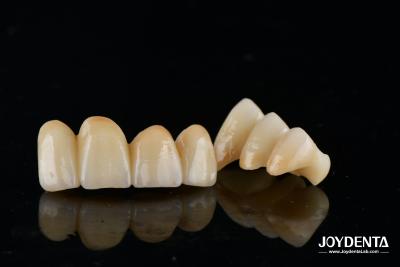 China Unveil True Biomimicry: Introducing Our Multi-Layered Zirconia Aesthetic Bridge for sale