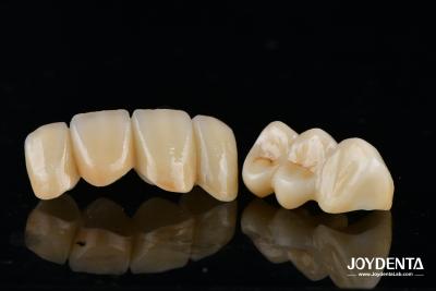China Unveil True Biomimicry: Introducing Our Multi-Layered Zirconia Aesthetic Bridge for sale