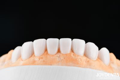 China Enhance Case Acceptance & Patient Communication with Our Diagnostic Wax-Up Service for sale