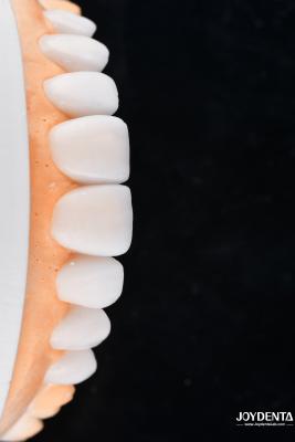 China Enhance Case Acceptance & Patient Communication with Our Diagnostic Wax-Up Service for sale