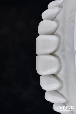 China Visualize the Result, Secure the Case: Our Diagnostic Wax-Up Service for sale