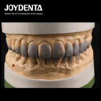 China Temporary Use Diagnostic Wax Ups Smooth Texture Teeth Wax Up Custom for sale