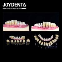 China Multiple Endosseous Dental Implants Internal Connection For Full Arch Restoration for sale