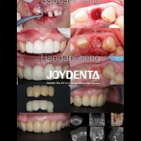 China Multilayered Gradient Technology Dental Zirconia Safe for sale