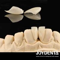 China High Durability Micro Veneer 0.2mm Thickness And Dependable Performance for sale