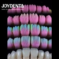 China The Joydenta Ceramic Veneer Process for sale