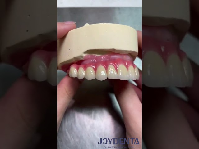 yellow resin temporary teeth smooth surface treatment precise and stable