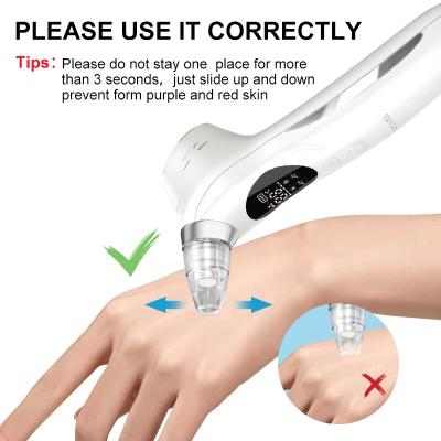 China Vacuum Facial Blackhead Removal Suction Device Rechargeable Deep Pore Cleanser Machine for sale