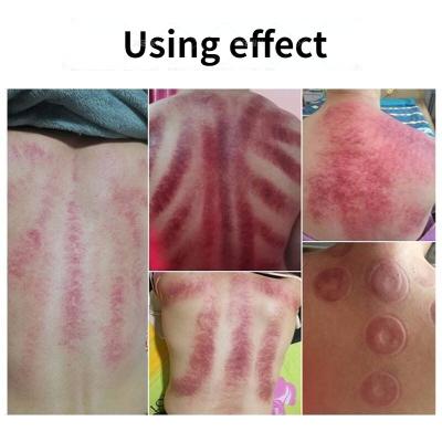 China Full Body Scraping Cupping Massager Back Vacuum Massage Machine For Cellulite Removal for sale