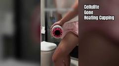 Heating Cupping Machine