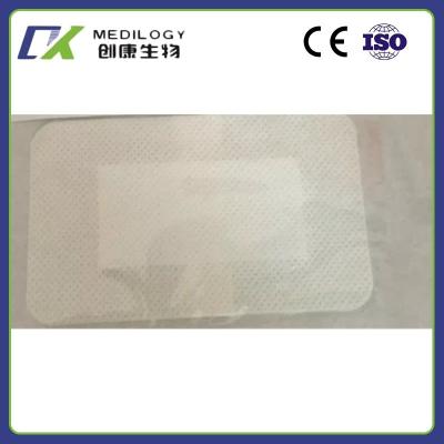 Cina Condimento arrotolato emostatico del gesso del tessuto non tessuto autoadesivo autoadesivo medico di Chuangkang in vendita