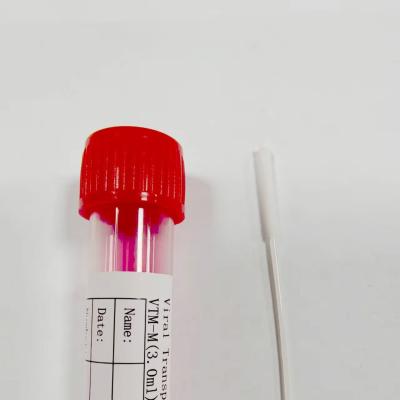 Cina Materiali di consumo medici monouso da 150 mm Componenti del mezzo di trasporto universale Plastica di classe I in vendita