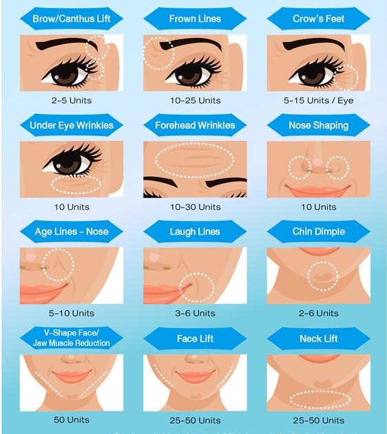 Botulinum Toxin Injections for Wrinkle Reduction Innotox botox botulax rentox nabota 1