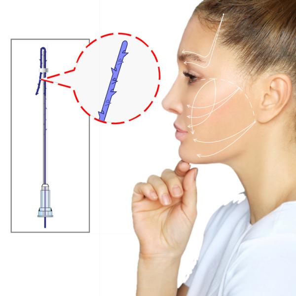 Quality Light Purple Mono 19G 21G PDO Thread Lift Eyes 38mm 60mm 90mm for sale