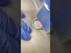 3-in-1 Picosecond Laser Machine - Remove Spots & Tattoos Safely