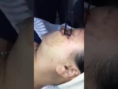 3-in-1 Picosecond Laser Machine - Verwijder vlekken en tatoeages veilig