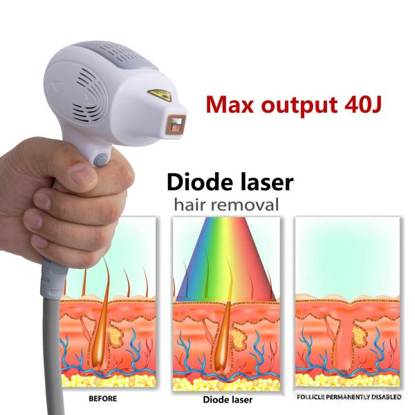Quality Home Mini Portable Diode Laser Machine Stationary Style Depilation Machine for sale