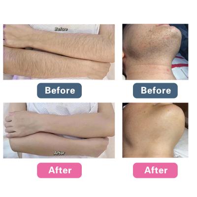 China Facial Rejuvenation Picosecond Laser Machine 1064nm 532nm 755nm Wavelength for sale