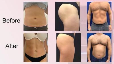 Cina Salone di bellezza EMS Slimming Machine Tipo desktop Per perdita di peso / stretta della pelle in vendita