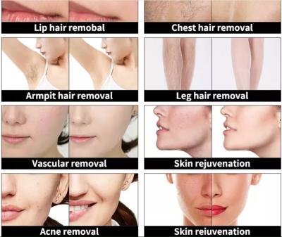Cina 4 in 1 Macchina di bellezza multifunzione a tre lunghezze d'onda Laser per la rimozione dei capelli tatuati in vendita