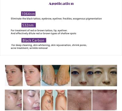 Cina Multifunzione OPT IPL RF ND YAG Laser Machine depilazione con 15 pollici touch screen in vendita