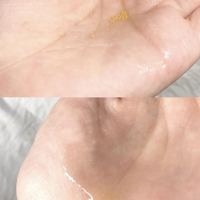 30ml Essence Face Serum 100% Pure Redness Radiant Skin Advanced Rosacea 1