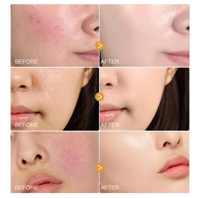 Cina MSDS Facial Skin Care Products Organic Chamomile Petals Serum Natural Facial Serum For Sensitive Skin in vendita