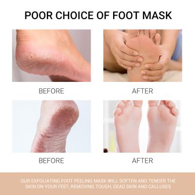 Cina Calzini esfoliare d'idratazione profondi di Juice Peach Foot Peel Mask in vendita