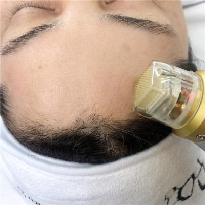 China Thermal Cooling Microneedling Fractional RF Face Lifting for sale