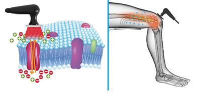 China Van het de Therapiemateriaal rf van de lichaamsmassage 300khz Slimme Tecar ROOT CET van de de Hittetherapie Te koop