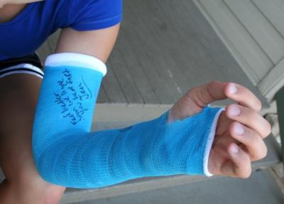 China CE FDA approved high quality breathable strong adhesive wholesale fiberglass medical cast for sale