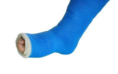 China Ansen High quality fiberglass medical casting tape 4in/othoprdic products for sale