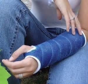 China Colorful Surgical Adhesive Bandage Elastic Waterproof Fiberglass Casting Tape for sale