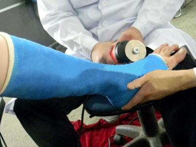 China Sterilization surgical orthopedic plaster saw for sale