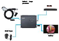 China LN-23YL_2M 1080P 60FPS Portable Endoscope Camera Sony CMOS Image Processor for sale