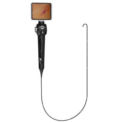 China Reusable Flexible Video Endoscope | 2.8/3.8/4.8mm for Airway & Tracheal Intubation for sale