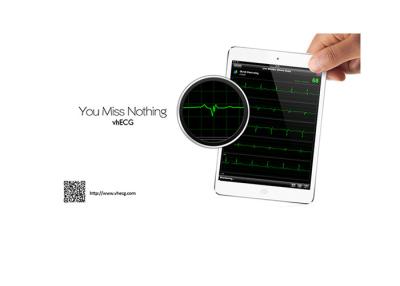 China Composite Material Wireless iPad ECG Heart Device For iOS With CE And FDA for sale
