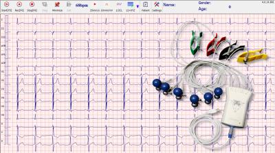 Grey White Handheld Ecg Monitor 12 Lead 10 Wire With Usb Cable Connection