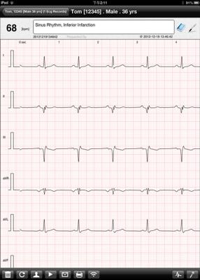 China Wireless Ipad home Digital ECG machine by wifi connection with ISO13485 for sale