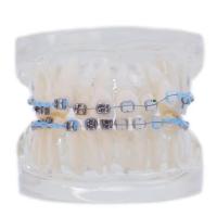 China Multi Color Human Teeth Model For Study Dental Orthodontic Teeth Model With Bracket for sale